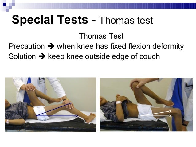 examination of the hip joint