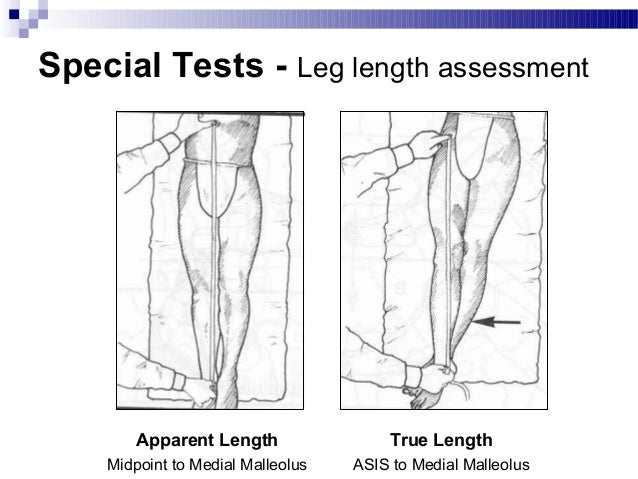 examination of the hip joint