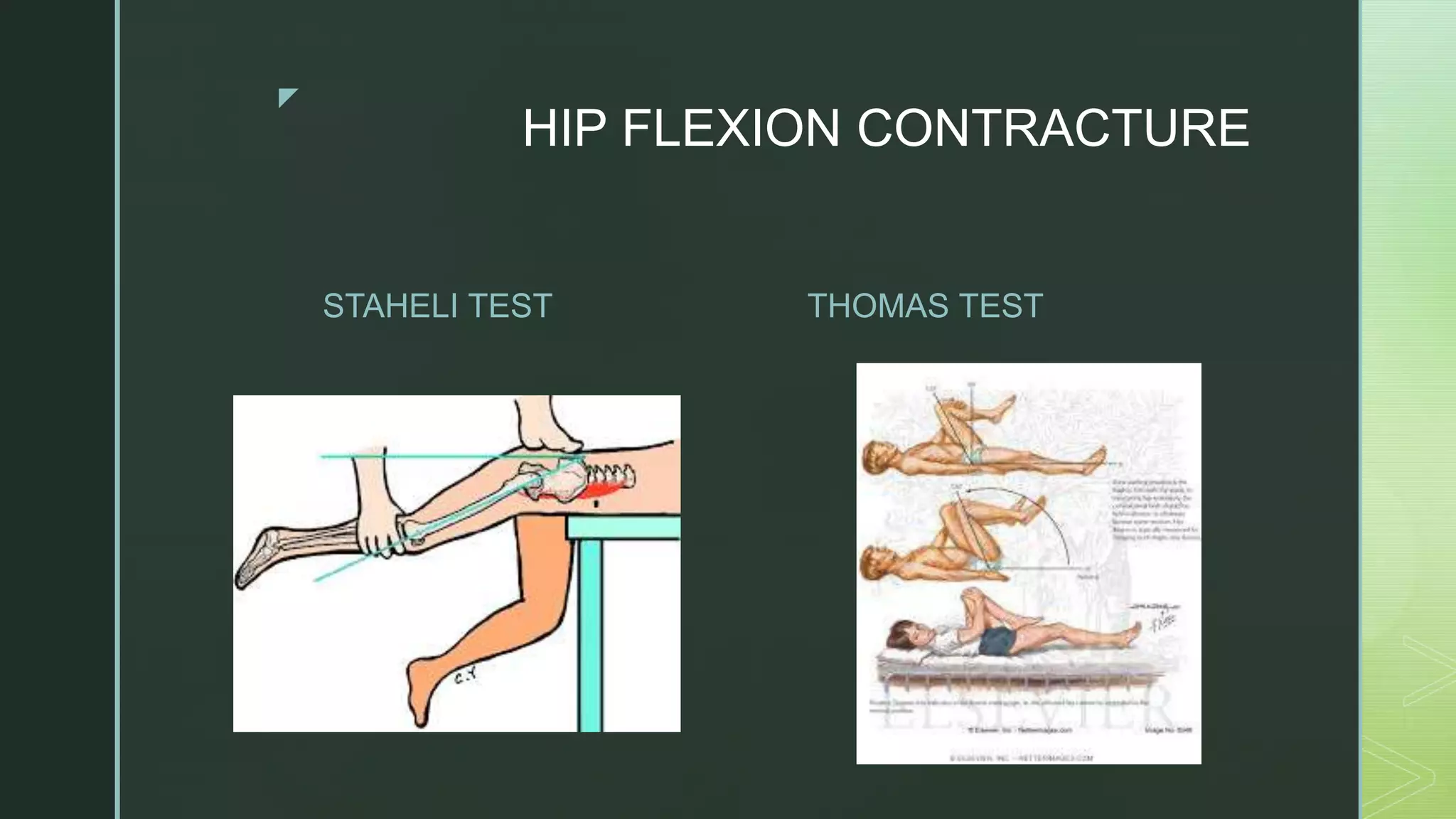 Hip and pelvis for beginners | PPTX