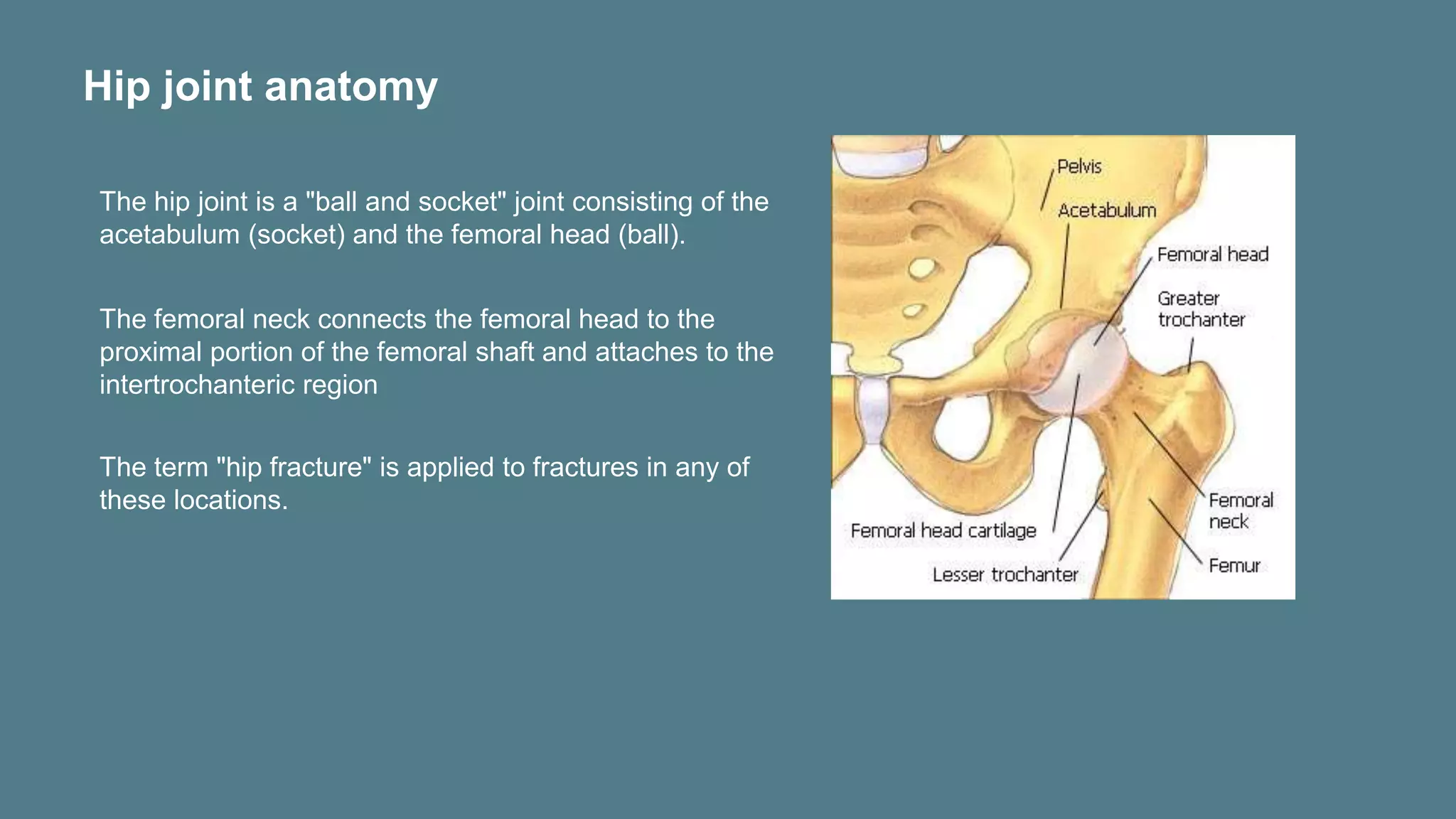 Hip fracture | PPTX