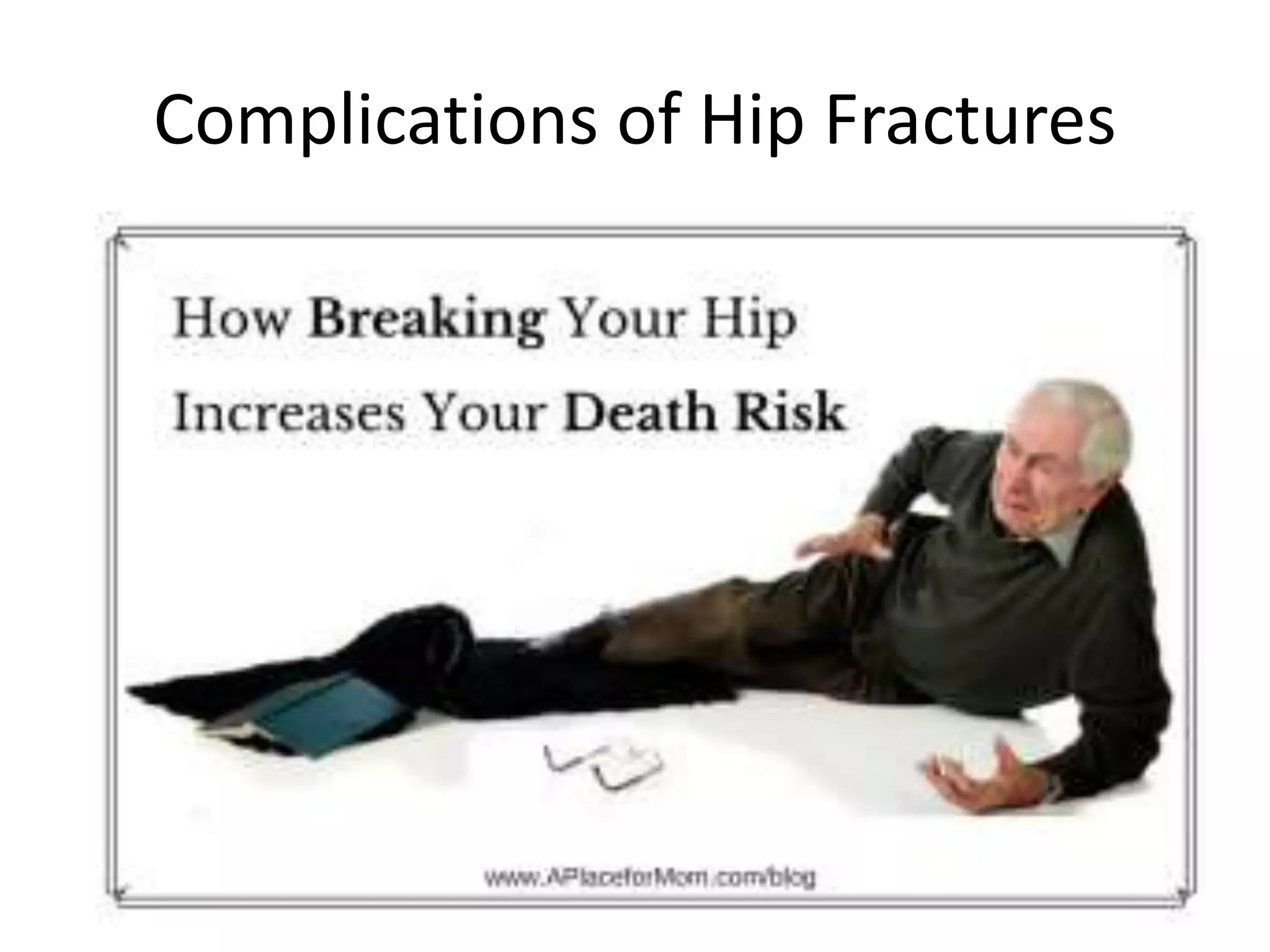 Hip fractures in elderly - general aspects | PPTX