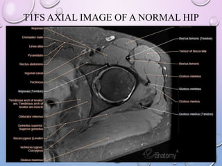 Hip girdle from anatomy to orthopedics | PDF