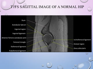 Hip girdle from anatomy to orthopedics | PDF