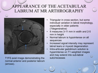 Hip girdle from anatomy to orthopedics | PDF