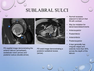 Hip girdle from anatomy to orthopedics | PDF