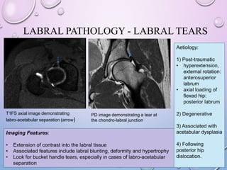 Hip girdle from anatomy to orthopedics | PDF