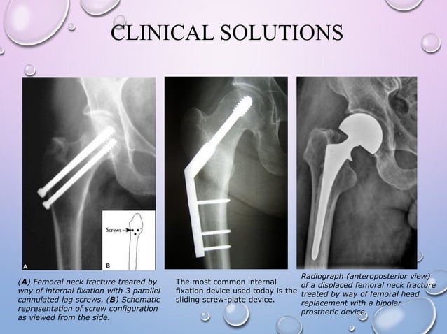 Hip girdle from anatomy to orthopedics