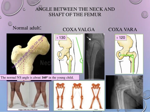 Hip girdle from anatomy to orthopedics