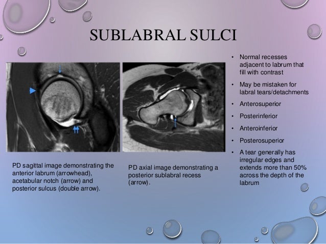Hip girdle from anatomy to orthopedics
