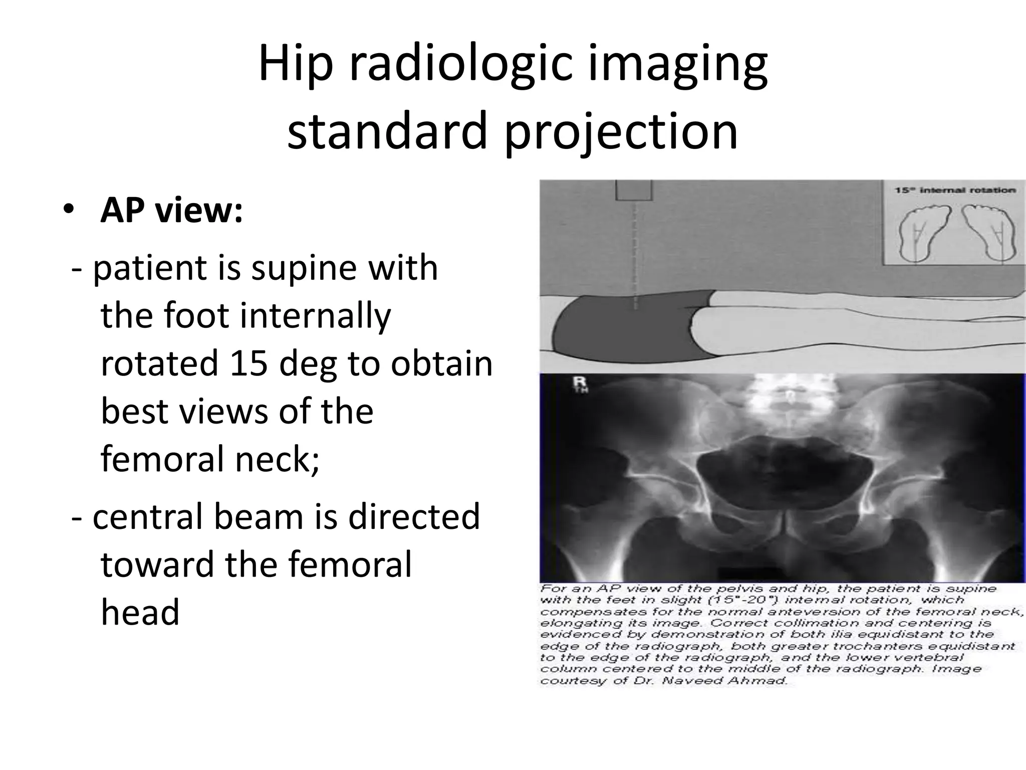 Hip imaging.pptx