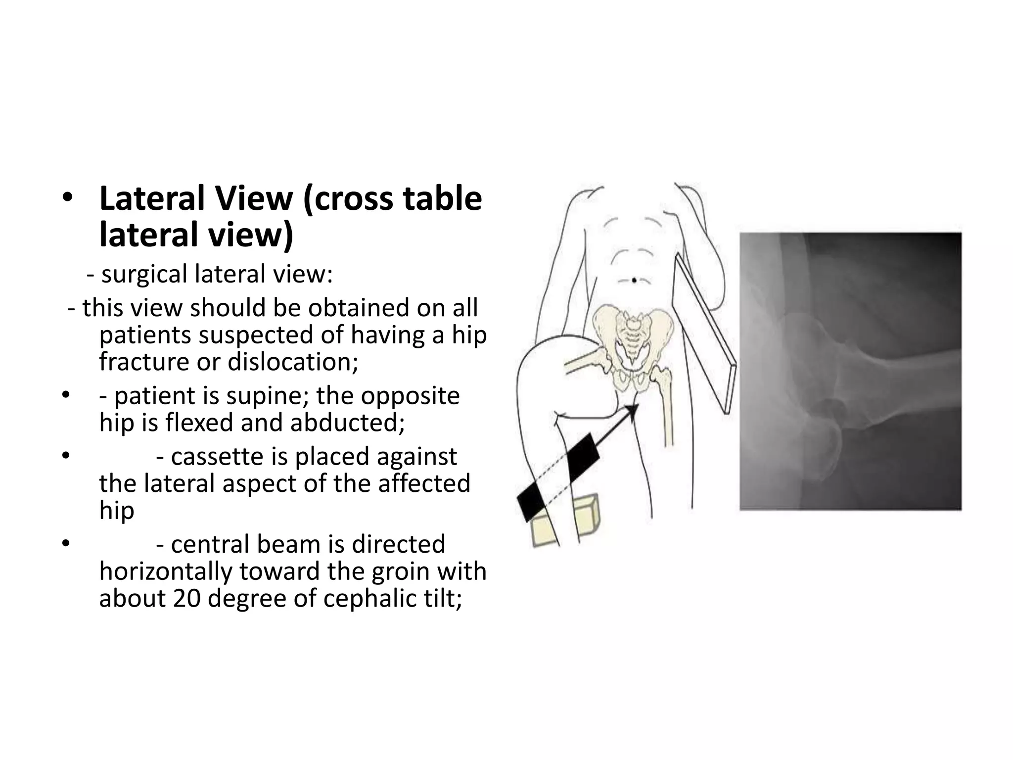 Hip imaging.pptx