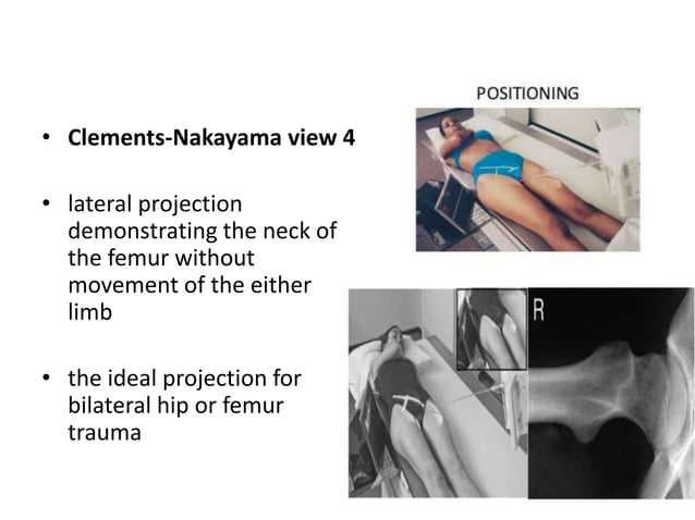 Hip imaging.pptx