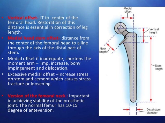 Hip implants dr.thahir
