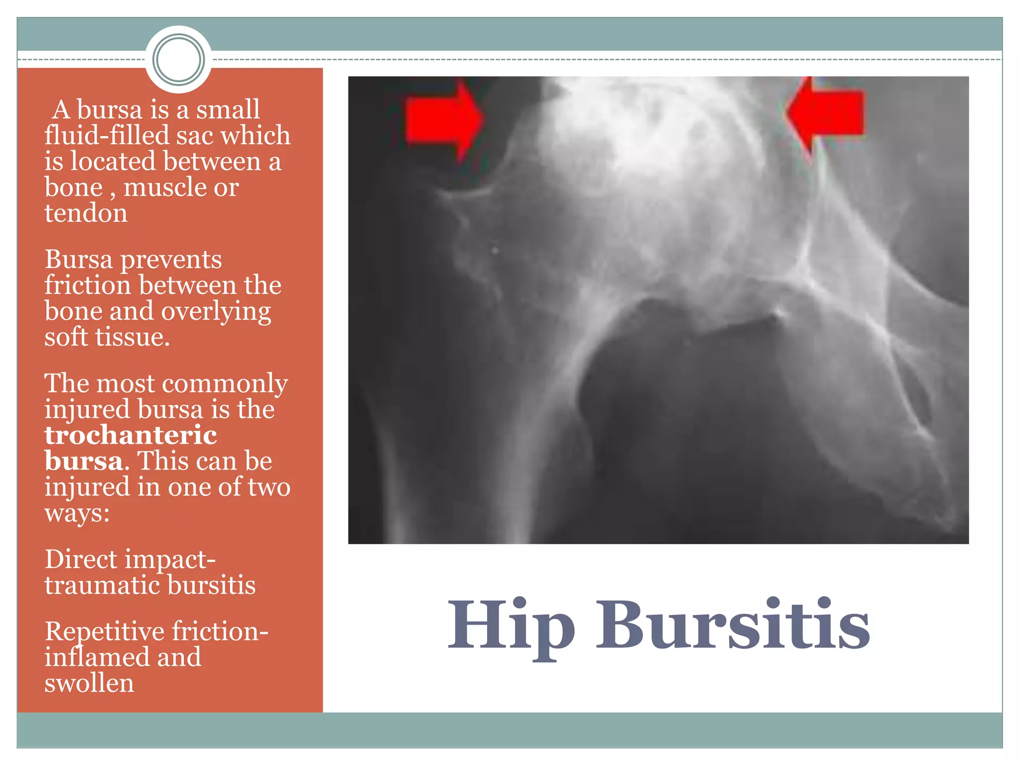 Hip Injuries.pdf