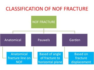 FRACTURE NOF AND INTER-TROCHANTRIC | PPTX