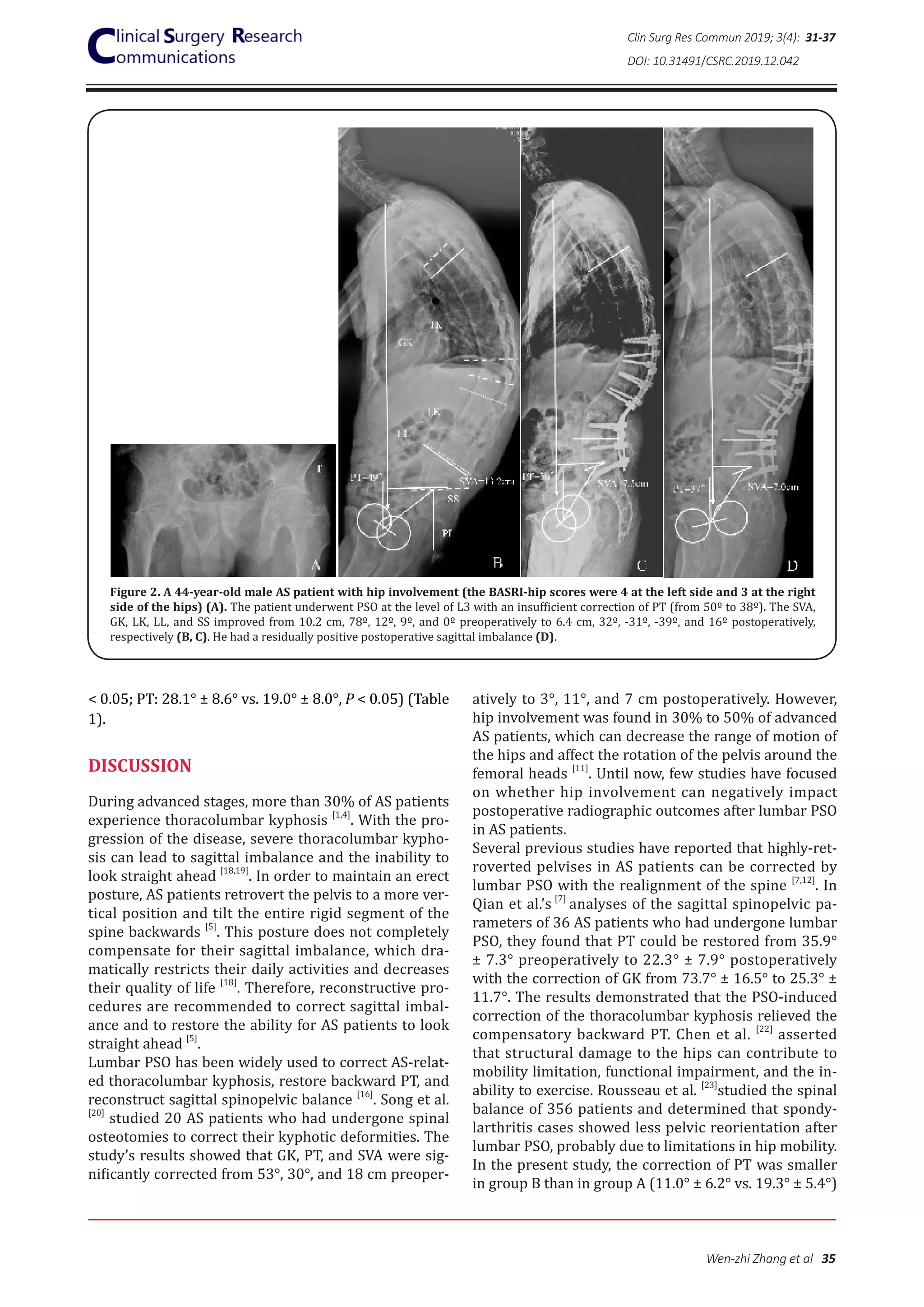 Hip involvement negatively impact the postoperative radiographic ...