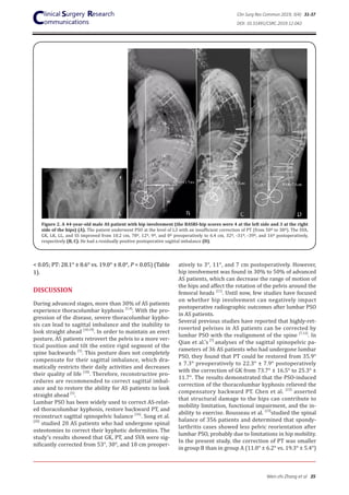 Hip involvement negatively impact the postoperative radiographic ...