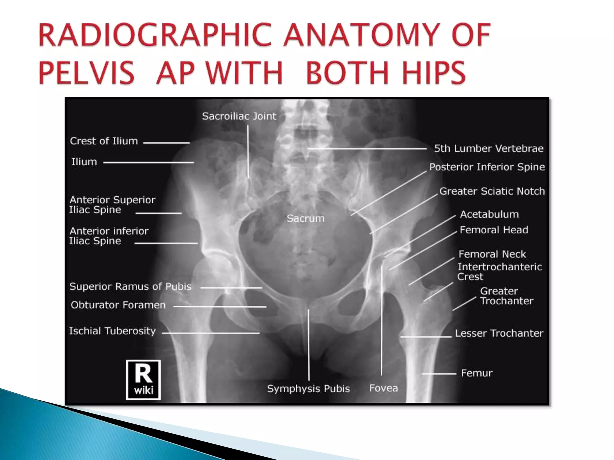 RADIOGRAPHIC VIEWS FOR HIP JOINT | PPTX