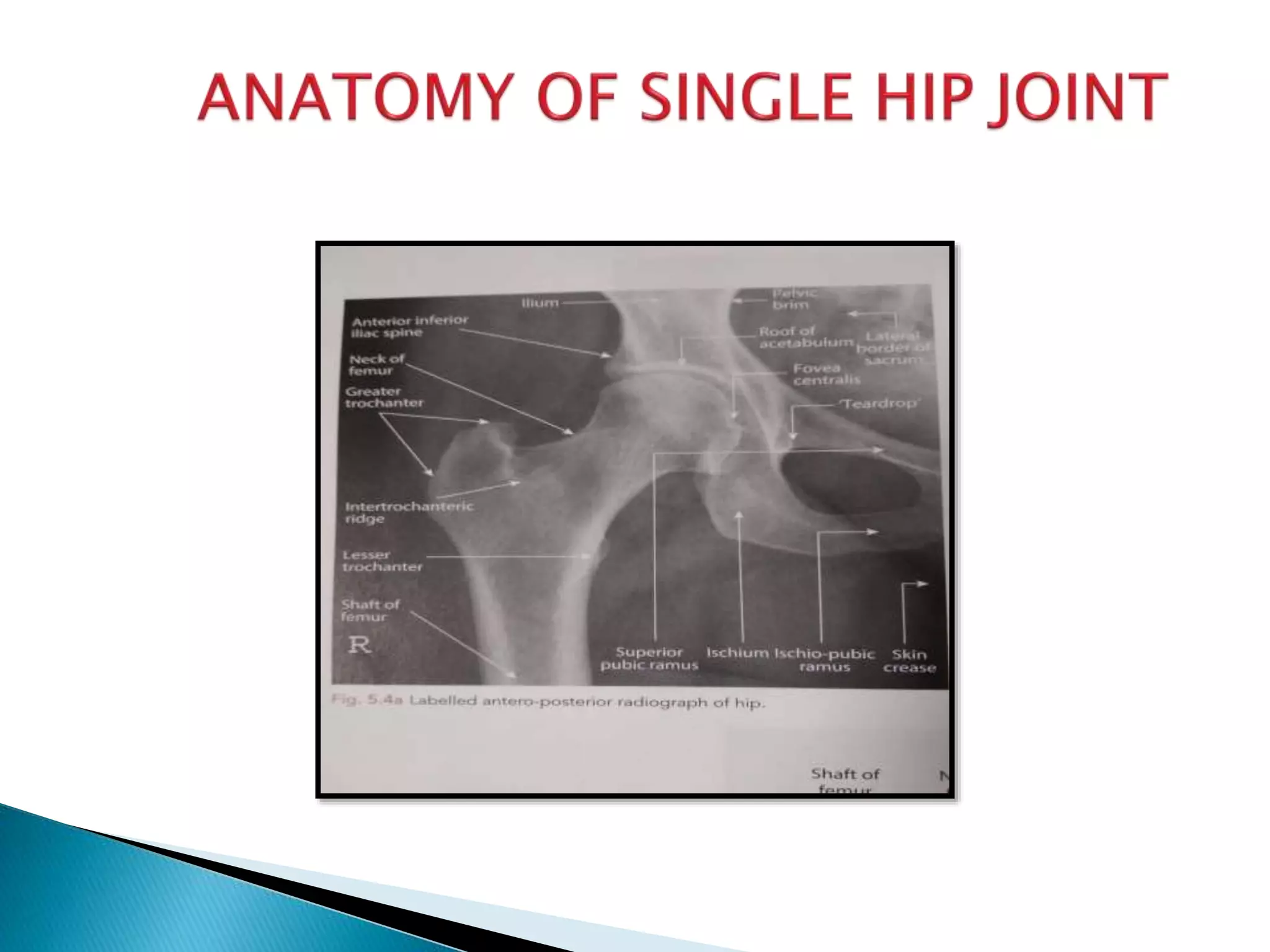 RADIOGRAPHIC VIEWS FOR HIP JOINT | PPTX | Death, Injury, or Military ...