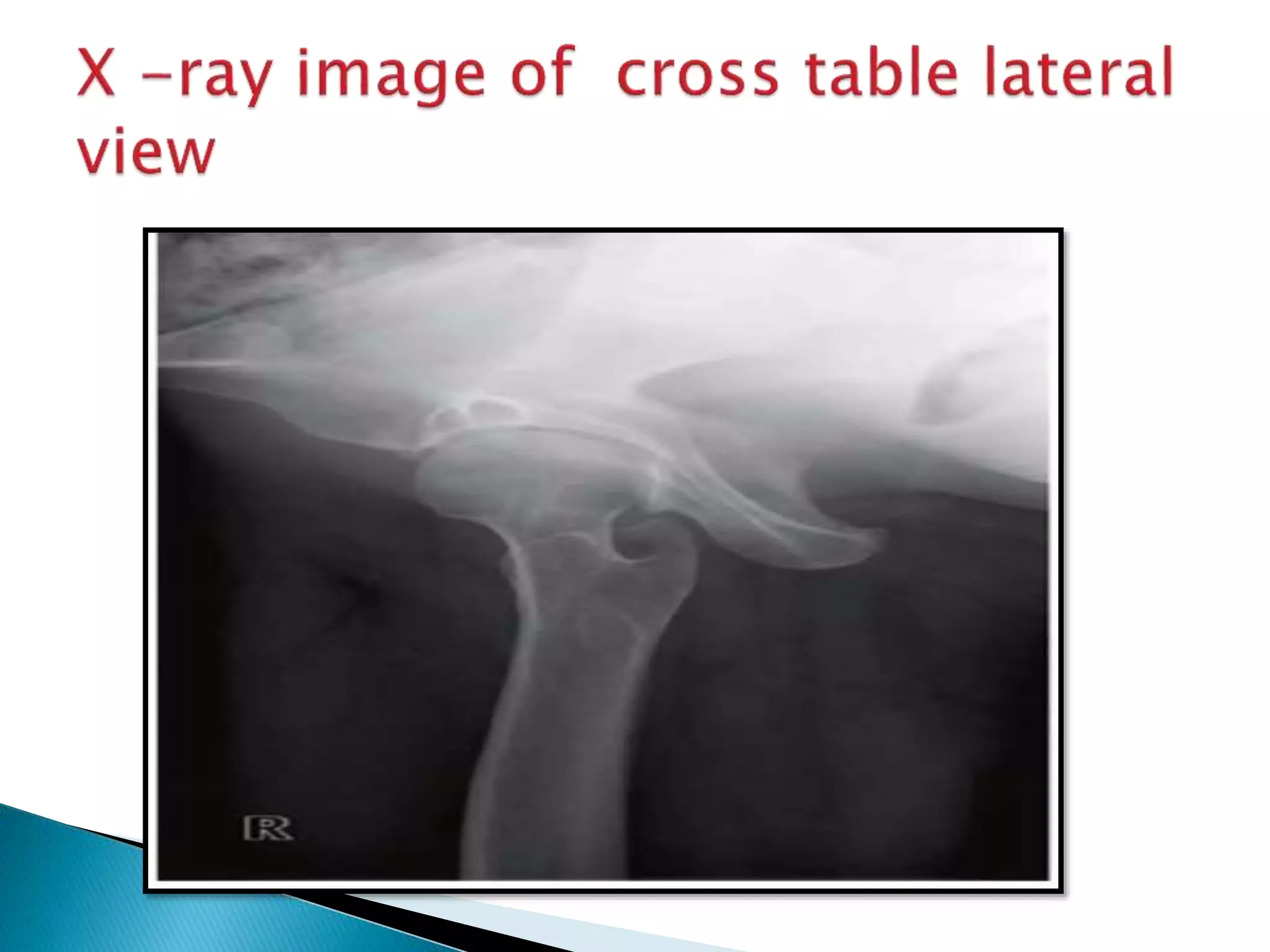 RADIOGRAPHIC VIEWS FOR HIP JOINT | PPTX