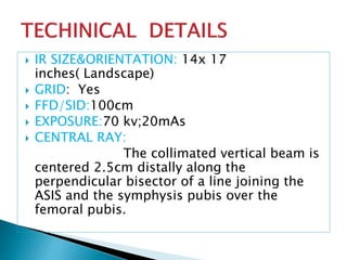 RADIOGRAPHIC VIEWS FOR HIP JOINT | PPTX