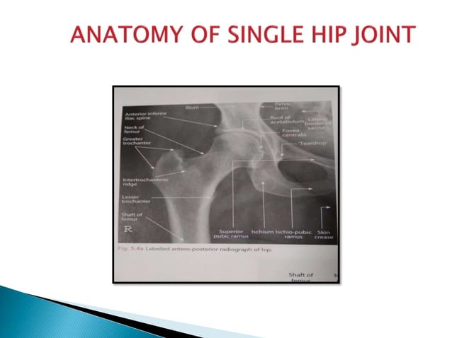 RADIOGRAPHIC VIEWS FOR HIP JOINT | PPTX | Death, Injury, or Military ...