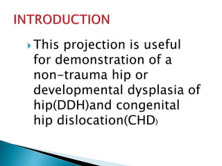 RADIOGRAPHIC VIEWS FOR HIP JOINT | PPTX