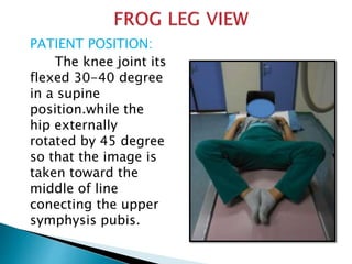 RADIOGRAPHIC VIEWS FOR HIP JOINT | PPTX