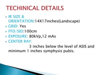 RADIOGRAPHIC VIEWS FOR HIP JOINT | PPTX