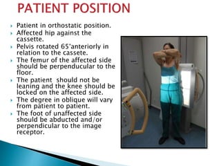 RADIOGRAPHIC VIEWS FOR HIP JOINT | PPTX