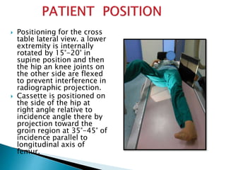 RADIOGRAPHIC VIEWS FOR HIP JOINT | PPT