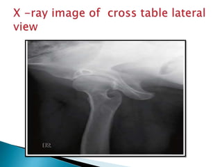 Cross Table Lateral X Ray