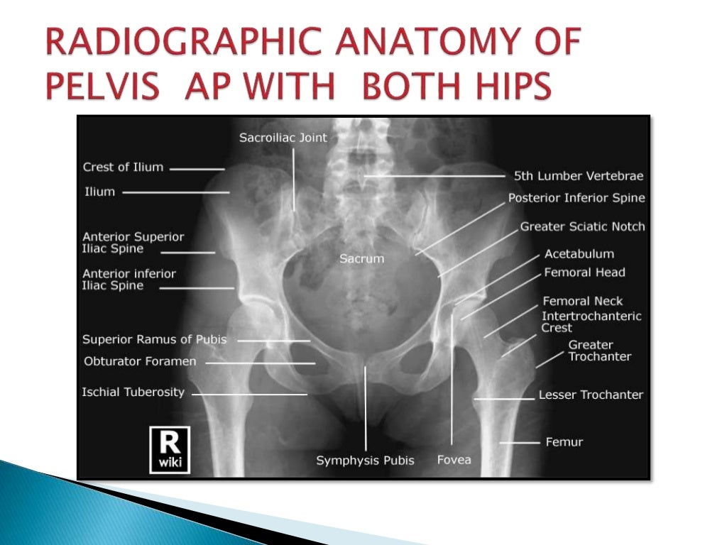 RADIOGRAPHIC VIEWS FOR HIP JOINT