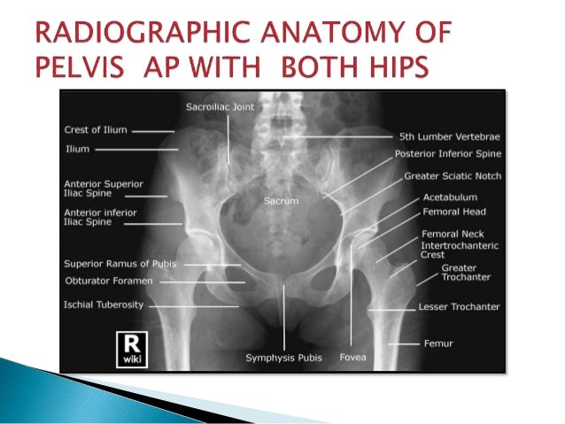 RADIOGRAPHIC VIEWS FOR HIP JOINT