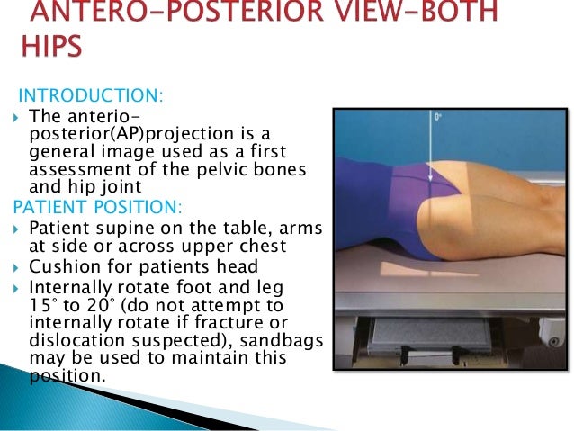 RADIOGRAPHIC VIEWS FOR HIP JOINT