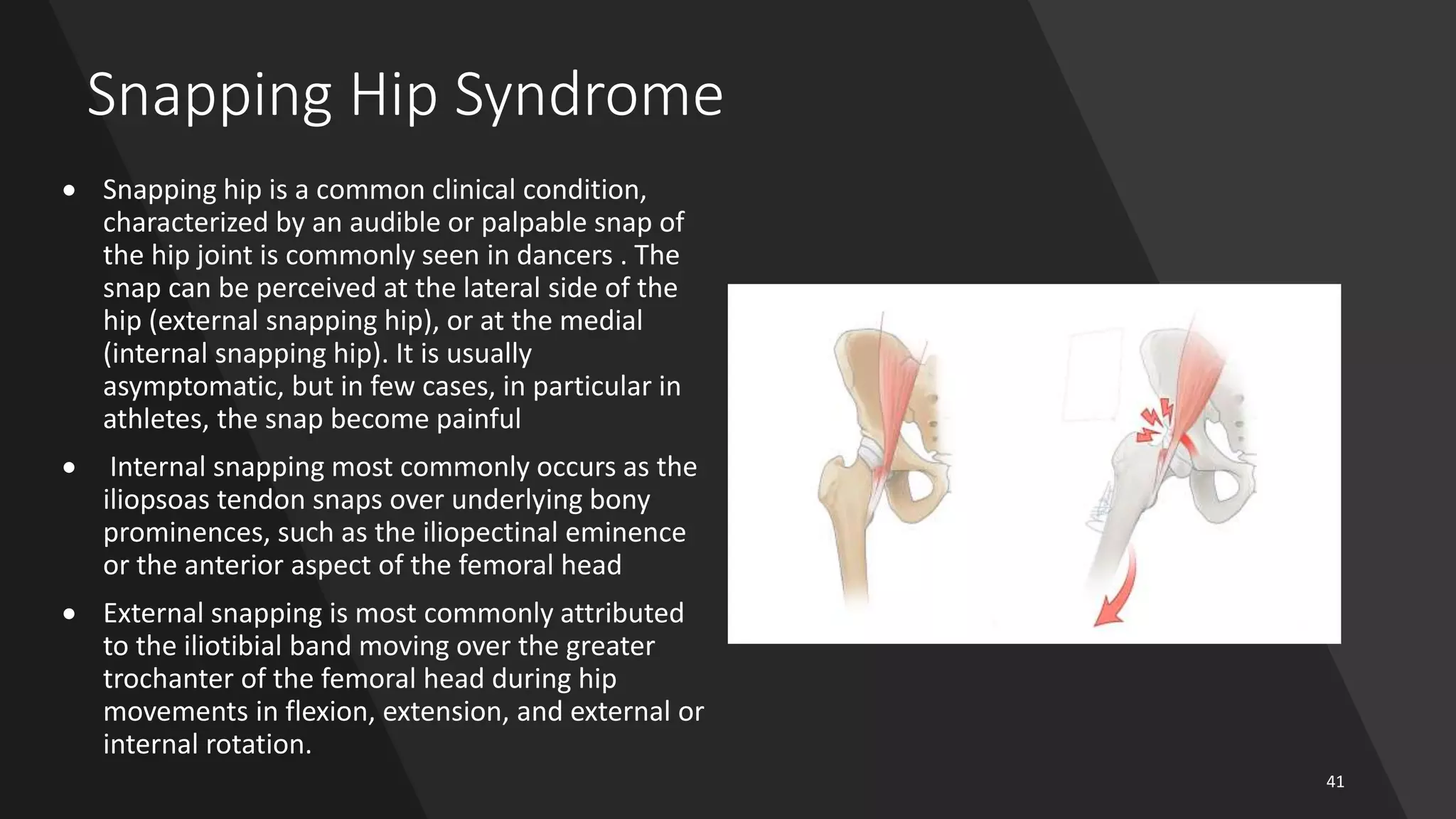 Hip Joint Biomechanics | PPTX