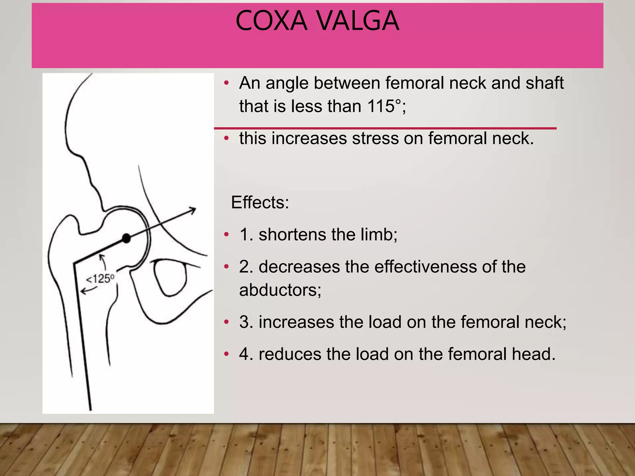 Hip Joint.pptx