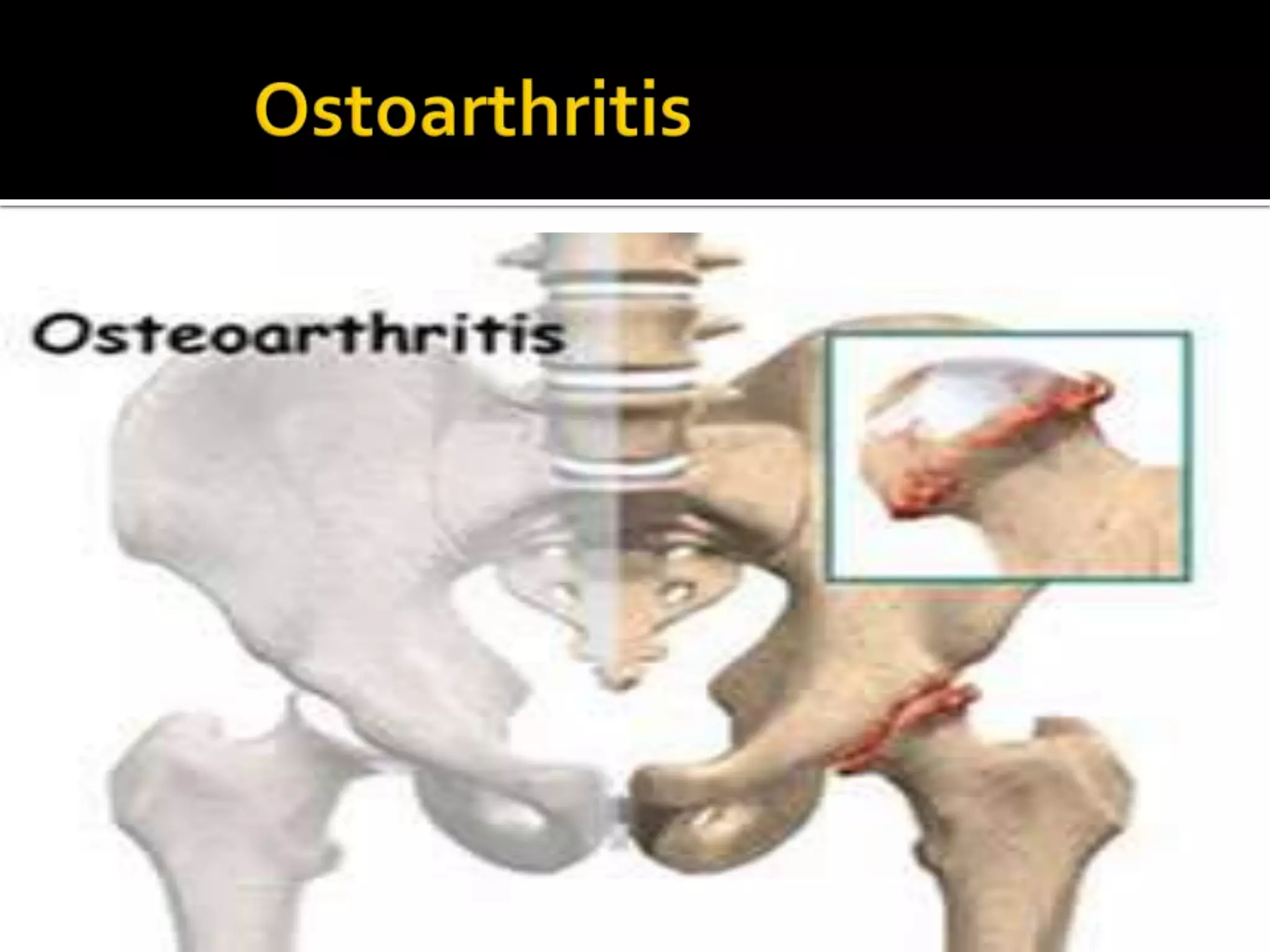 hip joint.ppt