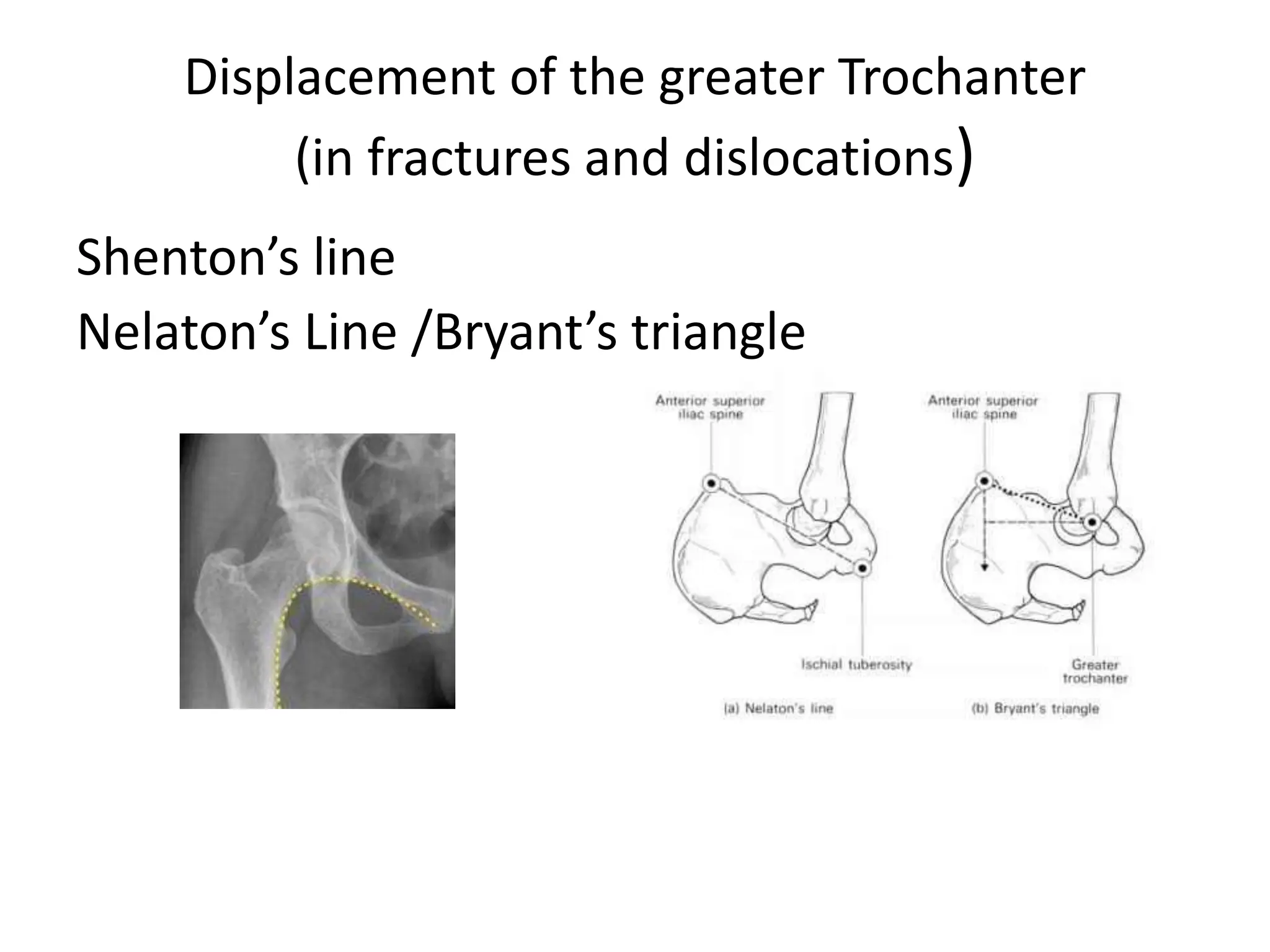 HipJoint attachment and action of muscles | PPTX