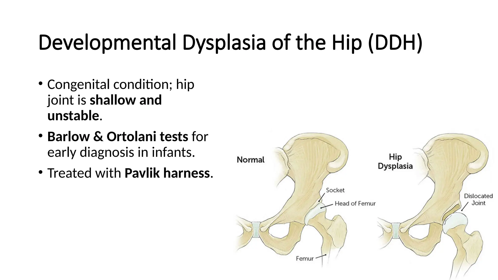 HIP JOINT.pptxHip joint, joints, anatomy | PPTX