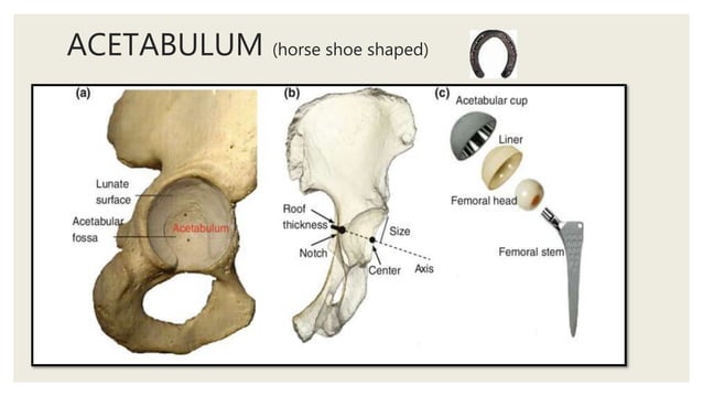 Hip joint - proximal and distal articular surface ppt | PPT