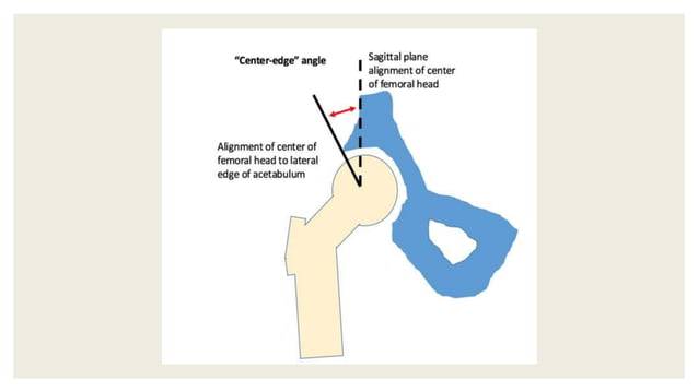 Hip joint - proximal and distal articular surface ppt | PPT