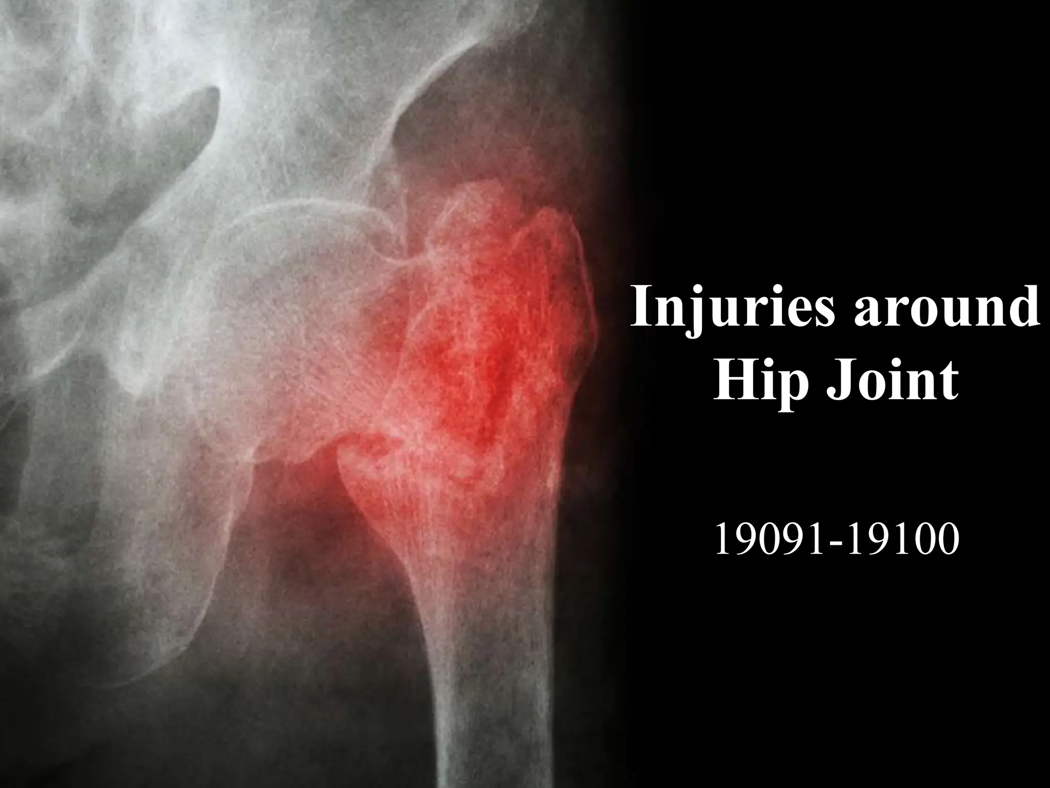 hip joint anatomy physiology and injuries.pptx