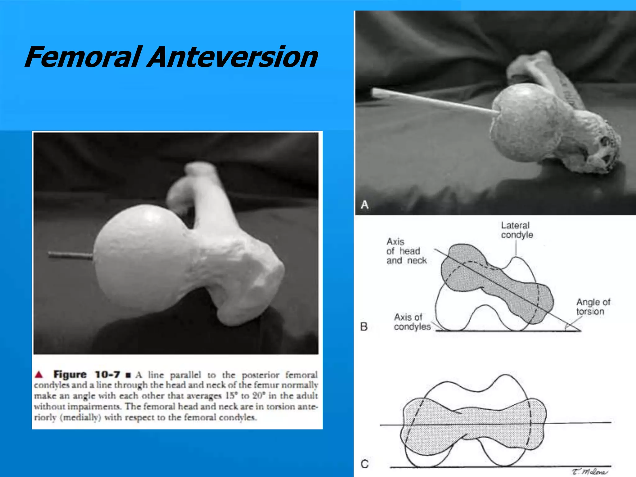 Hip joint anatomy and biomechanics | PPTX