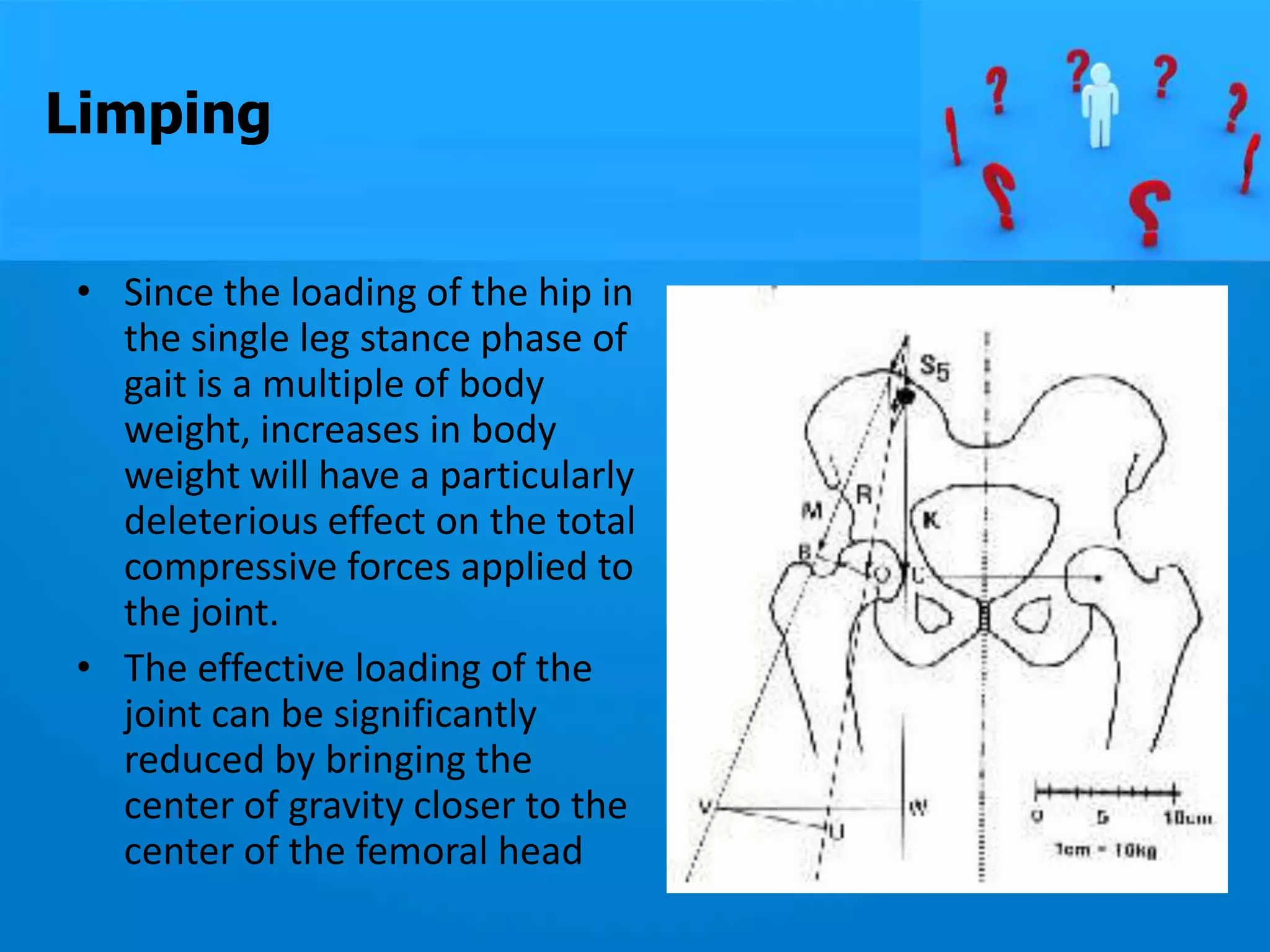 Hip joint anatomy and biomechanics | PPTX