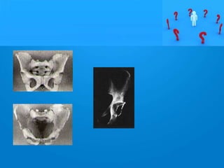 Hip joint anatomy and biomechanics | PPTX