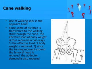 Hip joint anatomy and biomechanics | PPTX