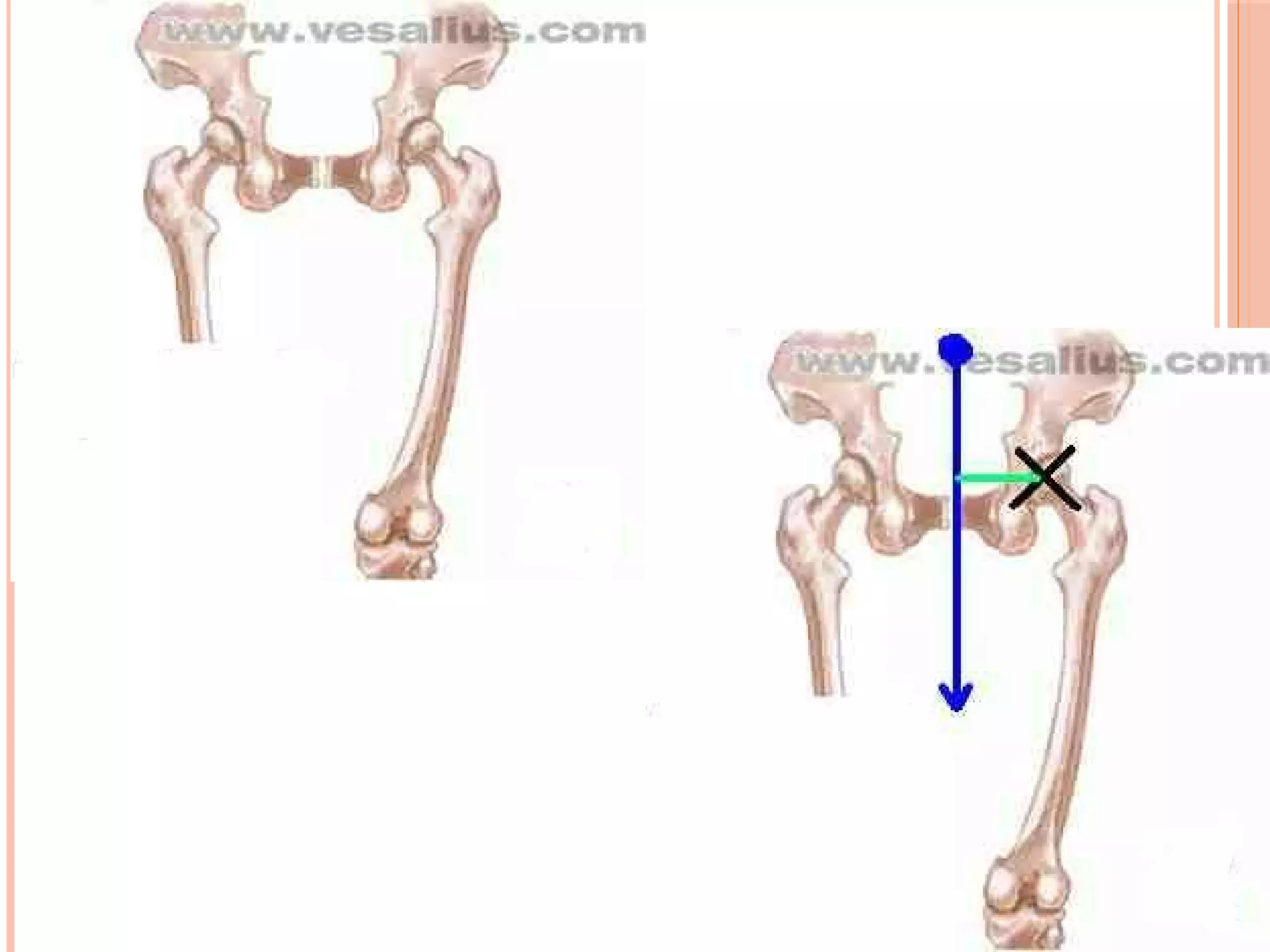 Hip joint biomechanics and pathomechanics | PDF
