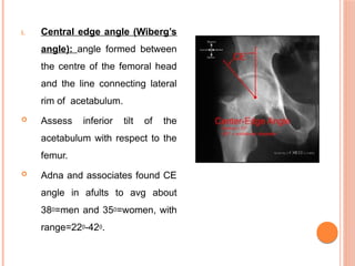 Hip joint biomechanics and pathomechanics | PPT