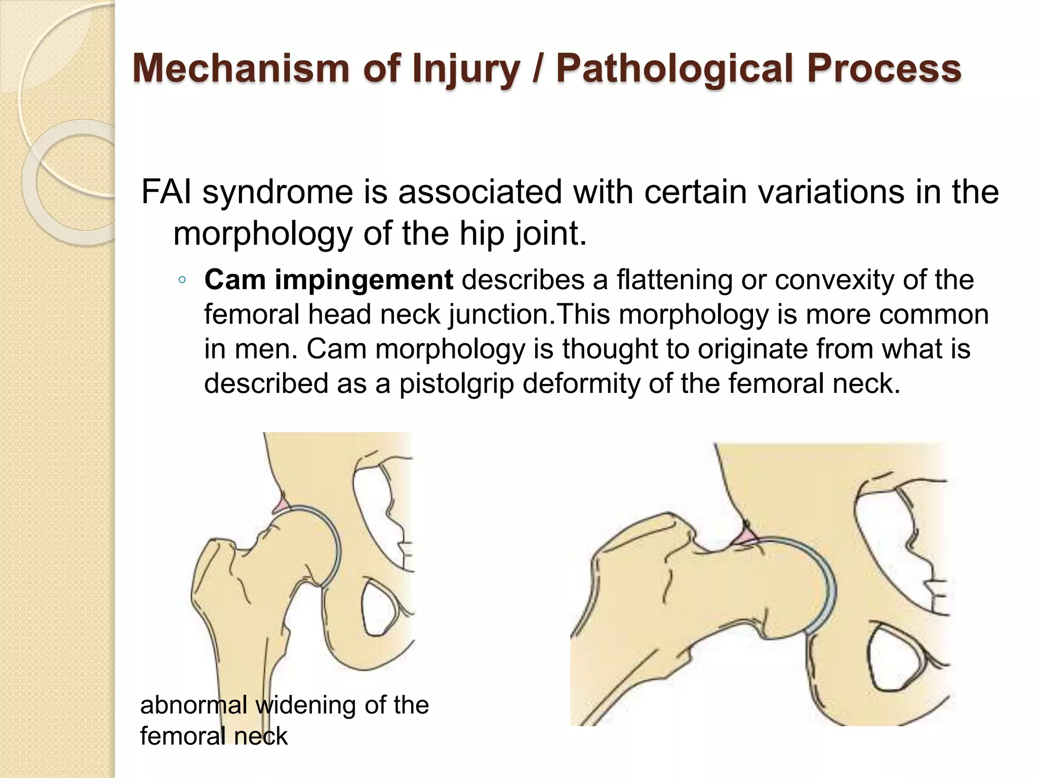Hip joint biomecanics | PPTX